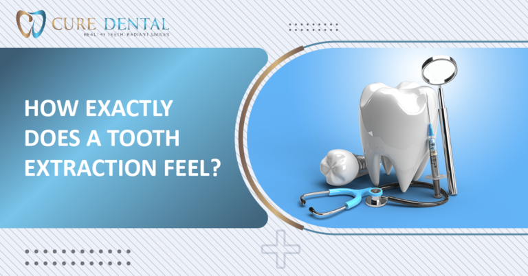 How Exactly Does A Tooth Extraction Feel? - Cure Dental