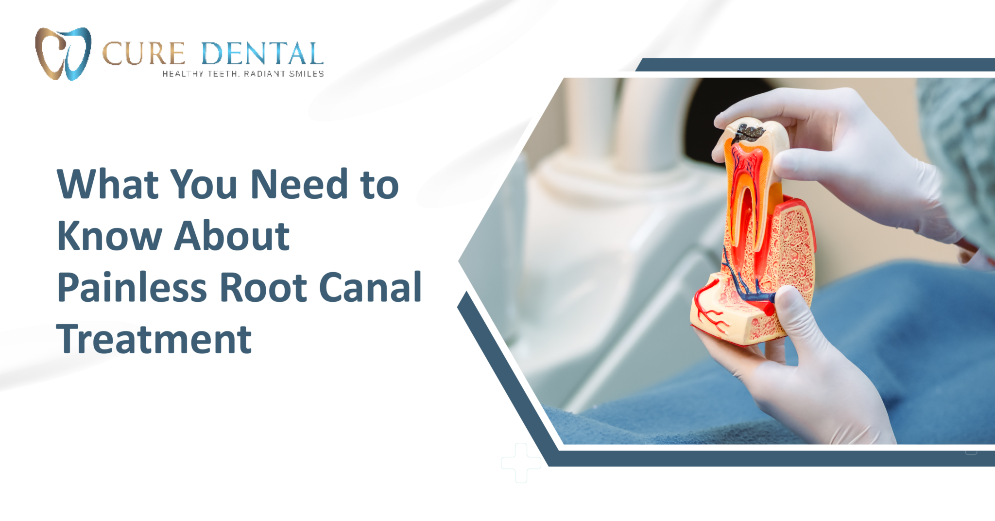 What You Need to Know About Painless Root Canal Treatment | Cure Dental