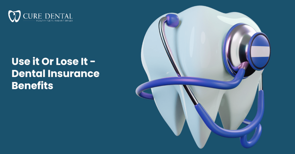 Use it Or Lose It - Dental Insurance Benefits | Cure Denatl